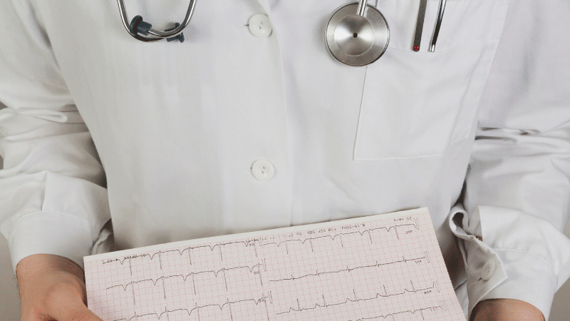 Guía Práctica de 3 Pasos para Leer un Electrocardiograma